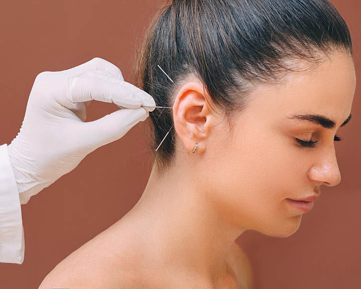 Here's Why The Ancient Practice Of Ear Seeding Is Gaining Popularity O