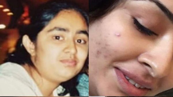 Meet Vibhuti Arora, The Face Yoga Expert Busting Myths On Skincare